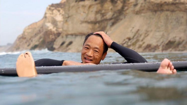 Albert Lin, pria yang mengitari dunia dengan sebelah kaki bionik