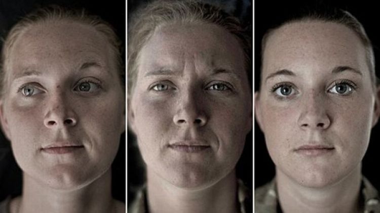 Mencengangkan Perubahan Wajah Tentara Sebelum Saat Usai Perang