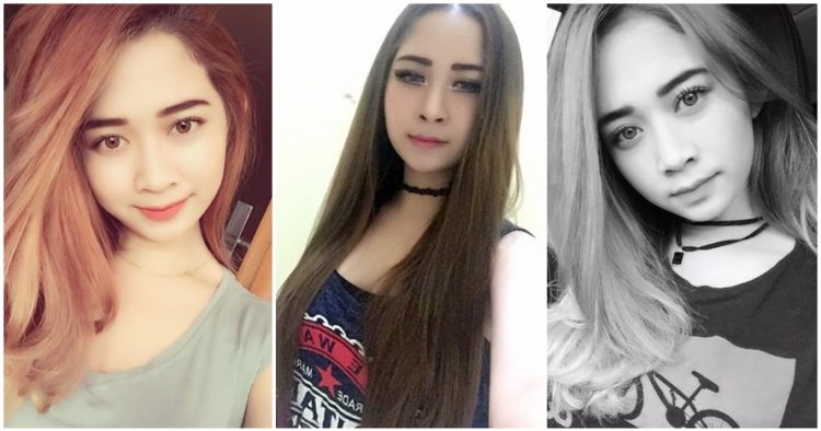 Ini foto-foto Intan Novita, gadis cantik yang disiram air keras, duh
