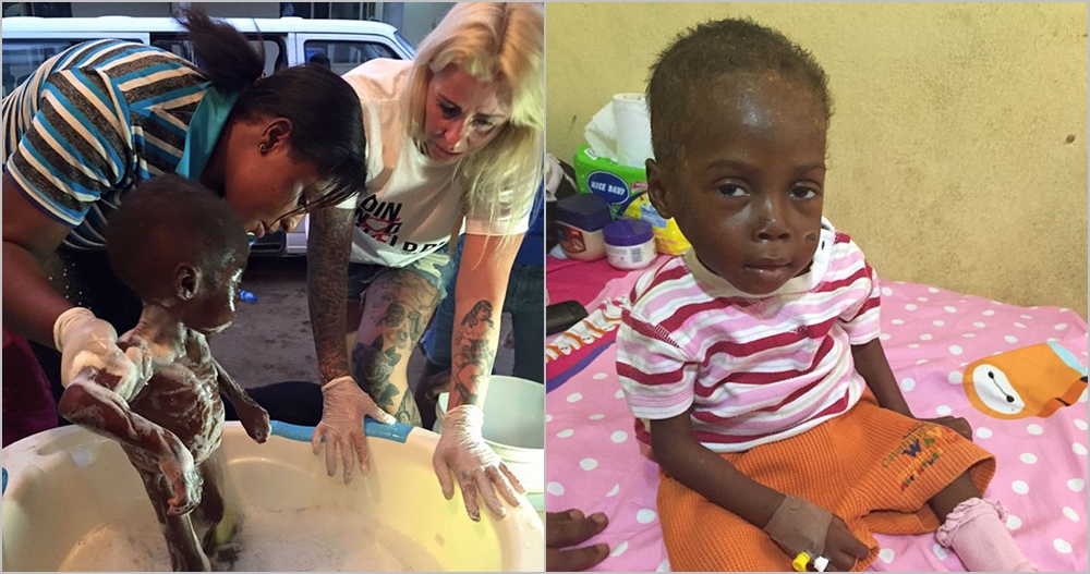 Ingat anak yang hampir mati kelaparan ini? Begini kabarnya sekarang