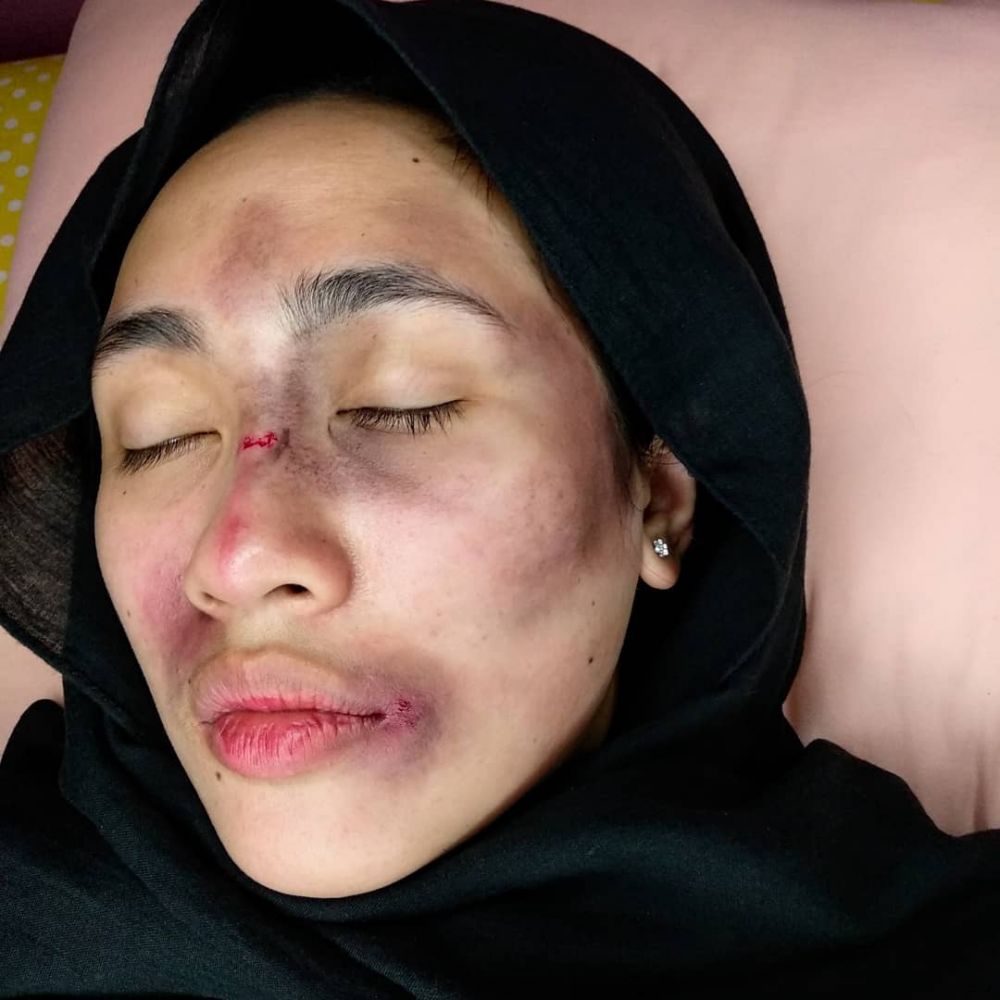Young Lex jadi inspirasi, ini 10 potret kocak makeup wajah babak