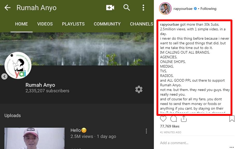 Nggak cuma Reza Arap, 5 seleb ini bantu yayasan kanker Rumah Anyo