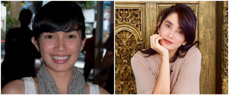 Potret 7 penyanyi sebelum vs sesudah tanam benang, manglingi