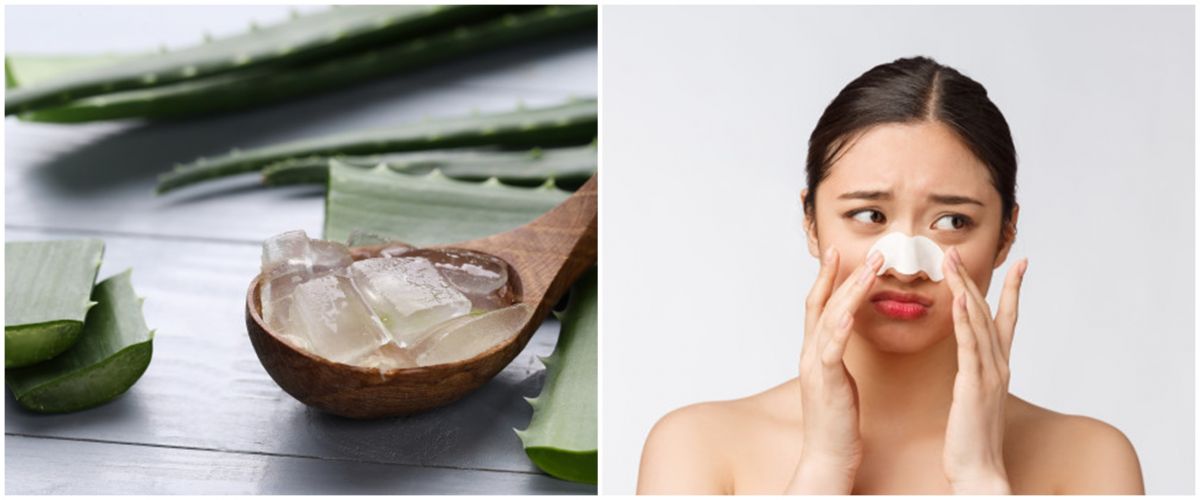 Cara membuat masker lidah buaya untuk obat komedo, mudah dan ampu