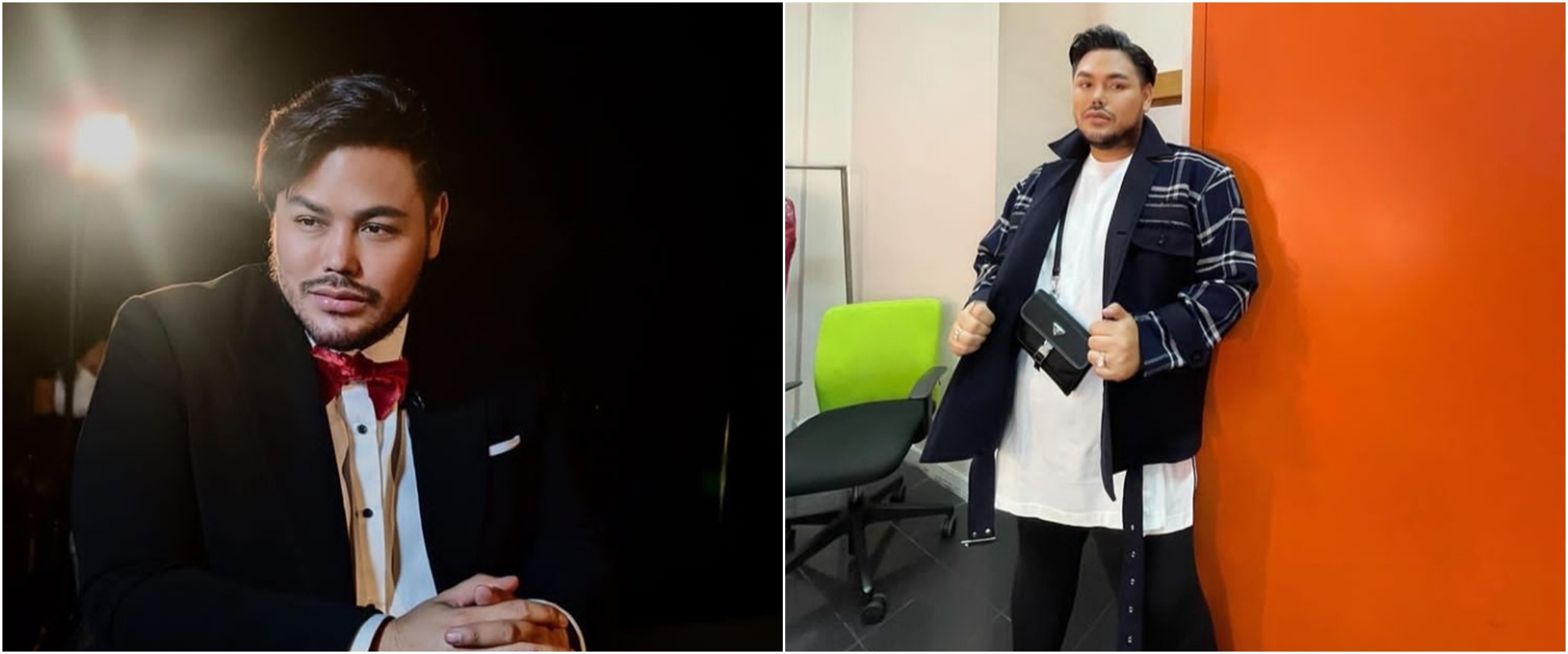 5 Perawatan Ivan Gunawan agar tampil maksimal, oplas rogoh Rp 150