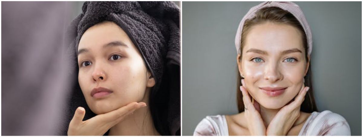 11 Manfaat daun jambu biji untuk wajah, bantu cerahkan wajah kusa