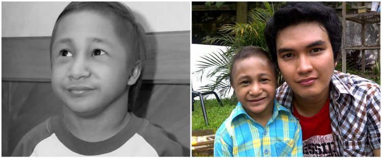 Dicky Topan pemeran adik Entong tutup usia, ini kronologi meninggalnya