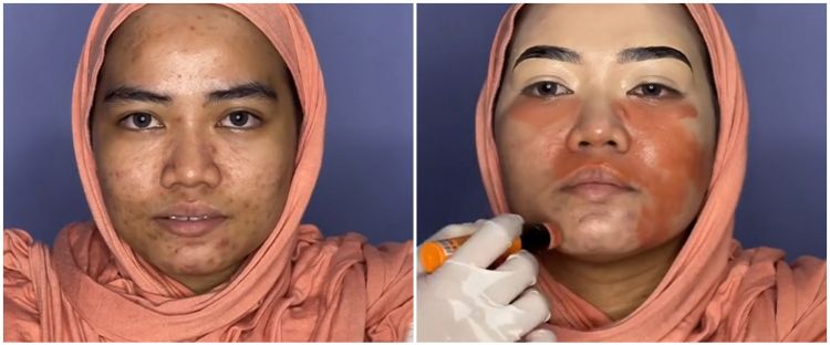 Transformasi makeup barbie look wanita berjerawat, hasil bikin takjub