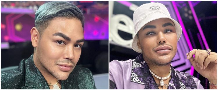 Ivan Gunawan tampil dengan bibir kian tebal, tuai protes warganet