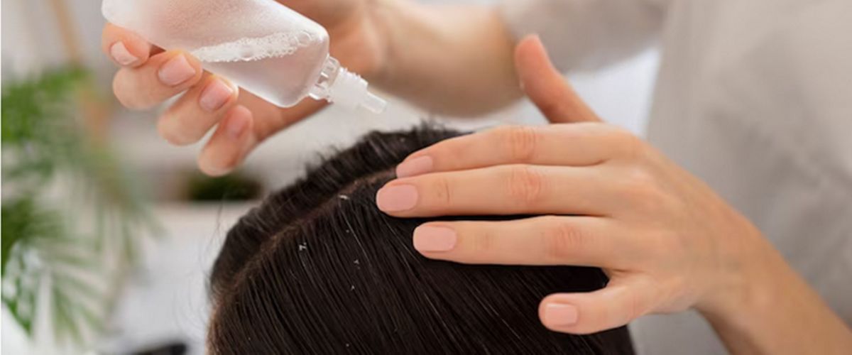 Atasi rambut rontok dan patah, begini cara membuat hair mask cuma