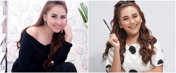 Potret Ayu Ting Ting sebelum dan sesudah tanam benang, hidung jadi kian mancung