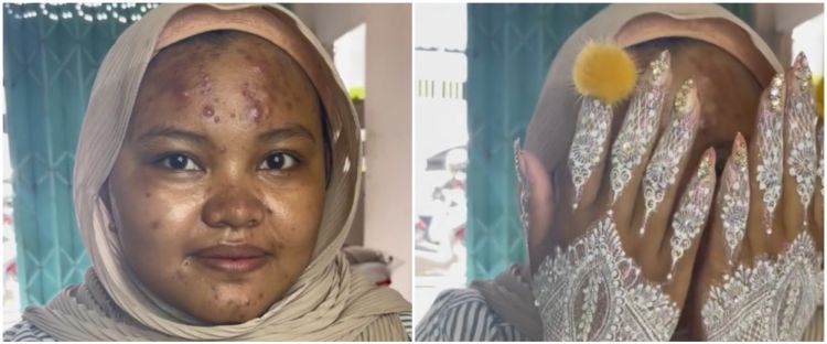 Tak pede muka penuh jerawat batu, penampilan wanita usai dirias MUA ...