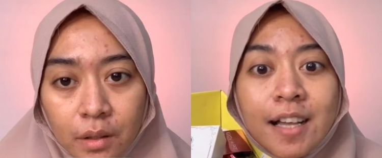 Transformasi gadis berjerawat dandan ala labrak pelakor, hasilnya bikin ...