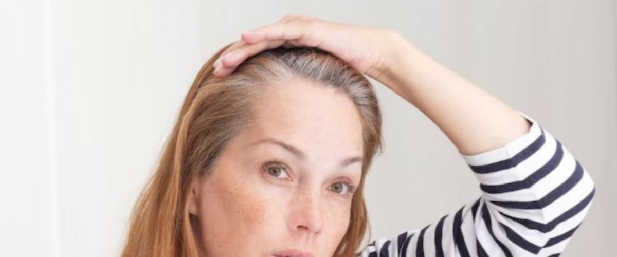 Tak perlu takut botak, ini cara menumbuhkan anak rambut area hair