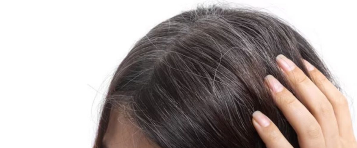 Cegah uban tumbuh kembali, ini cara menghitamkan rambut putih pak