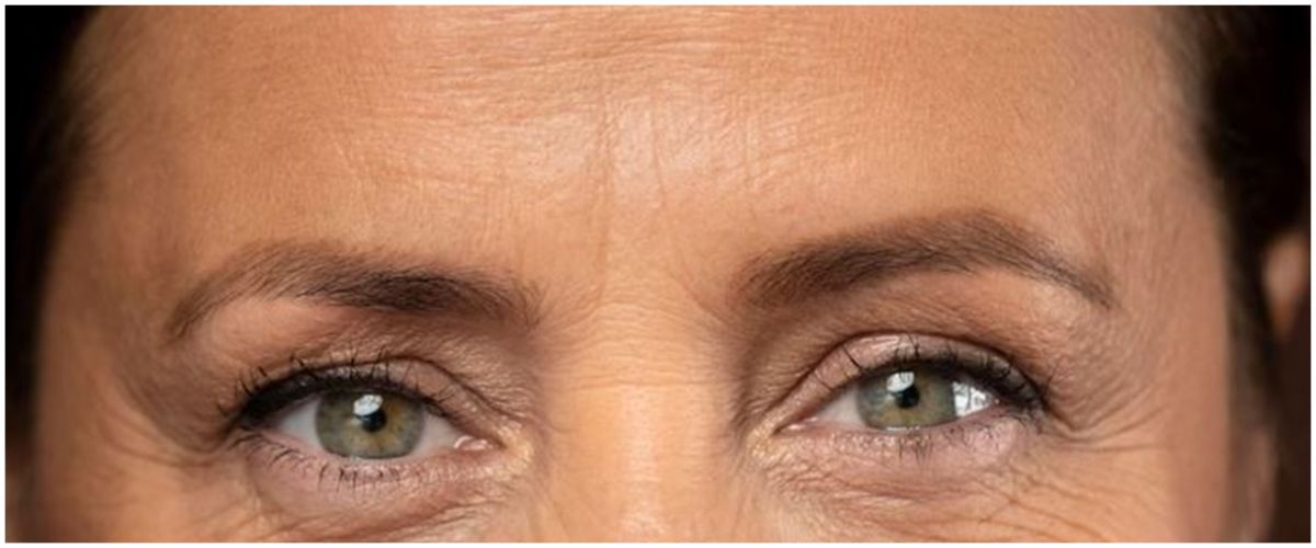 Kerutan di dahi hilang tanpa botoks, ini cara cegah penuaan agar