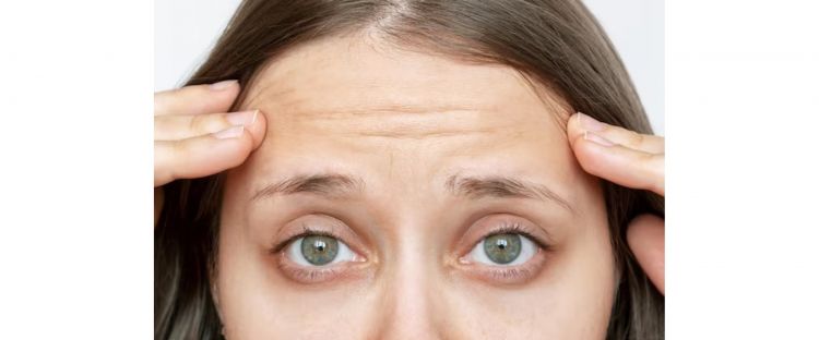 Bukan dengan alpukat, ini trik samarkan kerutan kulit area dahi dan ...