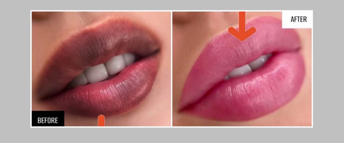 Tak perlu sulam, ini cara mengatasi bibir menghitam agar kembali merah alami pakai 1 jenis umbi ...