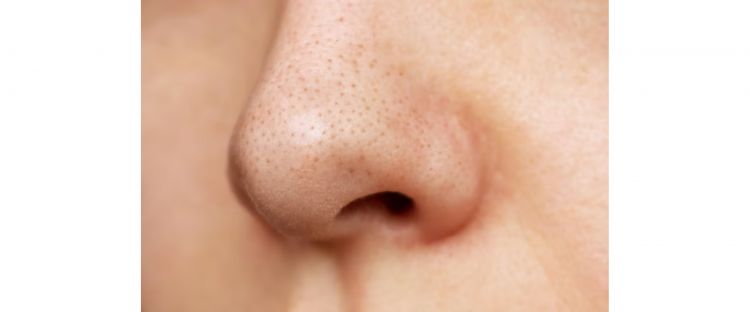 Nggak cukup cuci muka, ini cara membersihkan kulit dari komedo pakai ...