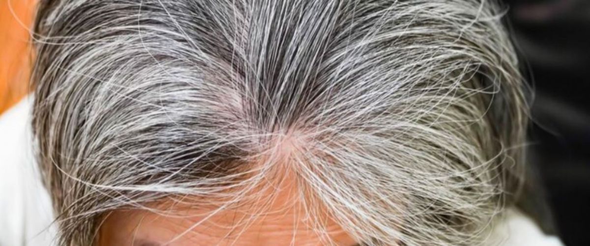 Nggak perlu pakai jintan, ini cara menghitamkan uban tanpa semir hanya ...