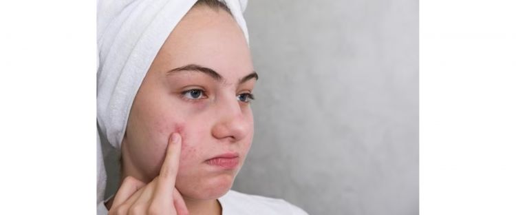 11 Rekomendasi skincare untuk kulit kering agar glowing di bawah Rp 200 ...