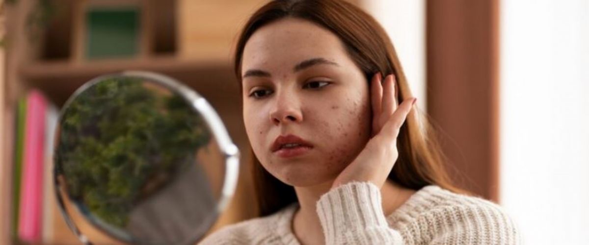 Tanpa beli produk scrub, begini cara memutihkan wajah kusam dan penuh ...