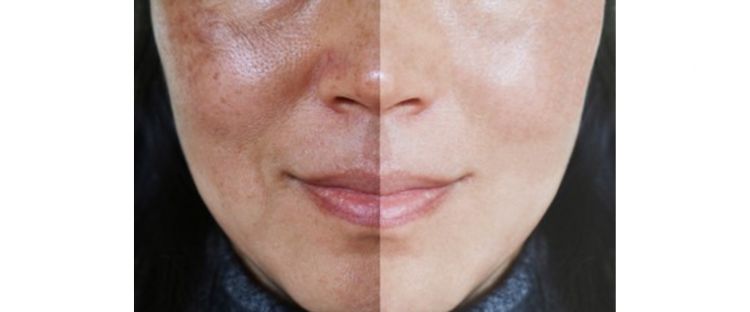 Jadi glowing dalam semalam, ini trik cerahkan wajah kusam akibat ... Jadi glowing dalam semalam, ini trik cerahkan wajah kusam akibat ...