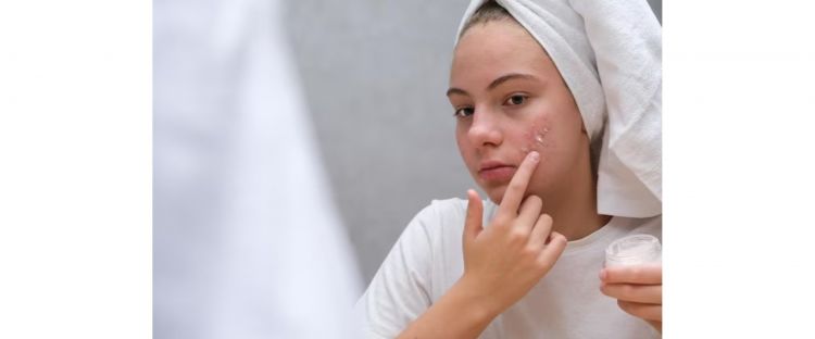 11 Rekomendasi skincare untuk kulit sensitif tanpa SLS dan paraben ...