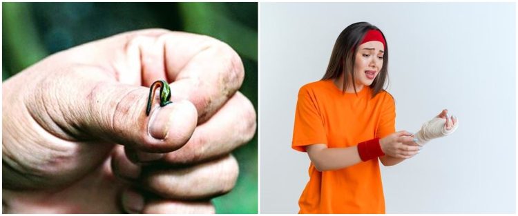 15 Arti mimpi digigit lintah menurut primbon Jawa, ternyata jadi ...