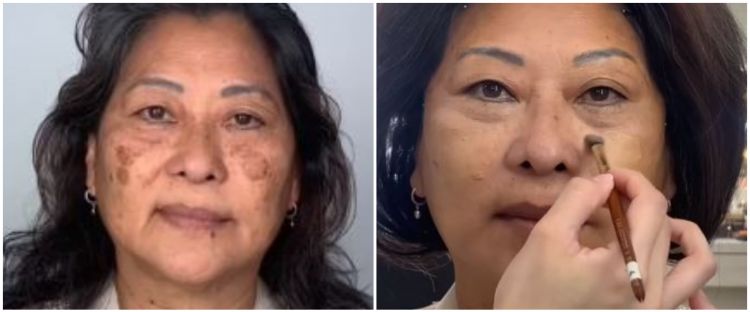 Transformasi makeup wanita dengan wajah penuh flek hitam ini bikin ...
