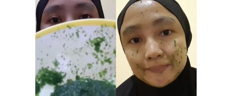 Bintik Hitam | Brilio.net