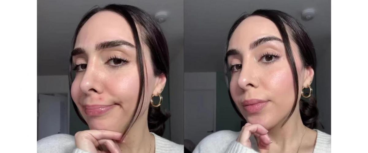 Without color corrector, this trick for women to cover reddish acne ...