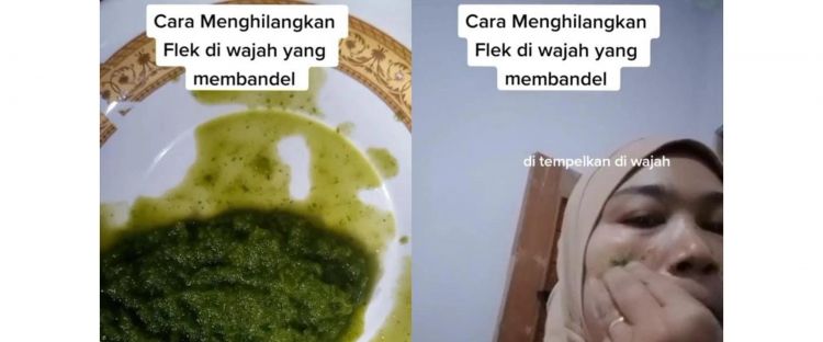 Cukup 1 jenis daun, begini trik sederhana hempas flek hitam di wajah ...