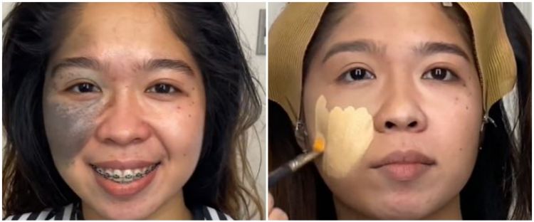 Tanda Lahir | Brilio.net