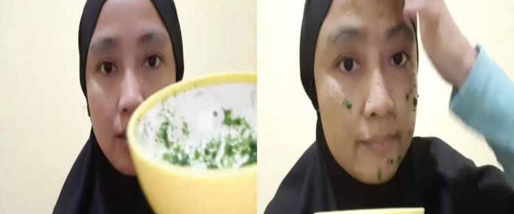Trik hilangkan noda hitam pada wajah pakai masker dari 1 jenis daun ...
