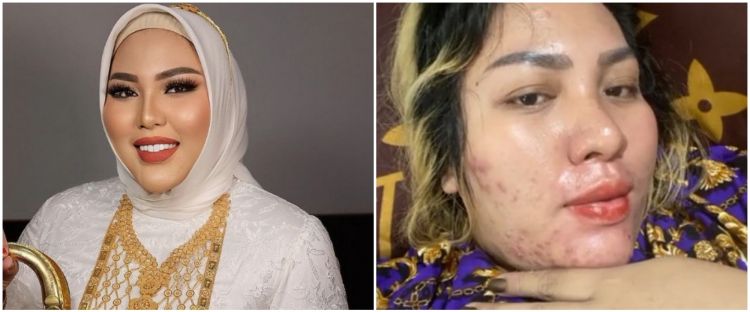 Jadi bos skincare penampilannya glowing, ini 9 potret Mira Hayati ...