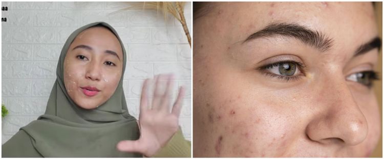 Modal cuma Rp 4 ribu, beauty vlogger ini bagikan cara mencerahkan bintik hitam pakai 1 bubuk minuman