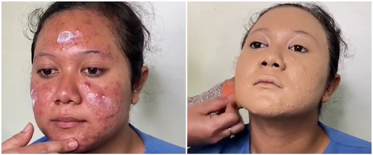 Transformasi makeup wanita wajah berjerawat jadi manten Jawa ini ...