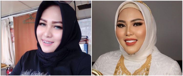 9 Potret bos skincare Mira Hayati sebelum vs sesudah pakai behel ...