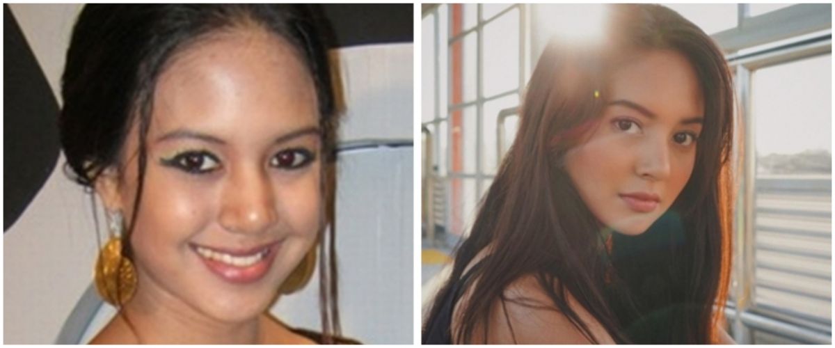 Faces become firmer and don't age, these portraits of 21 celebrities before and after Botox ...