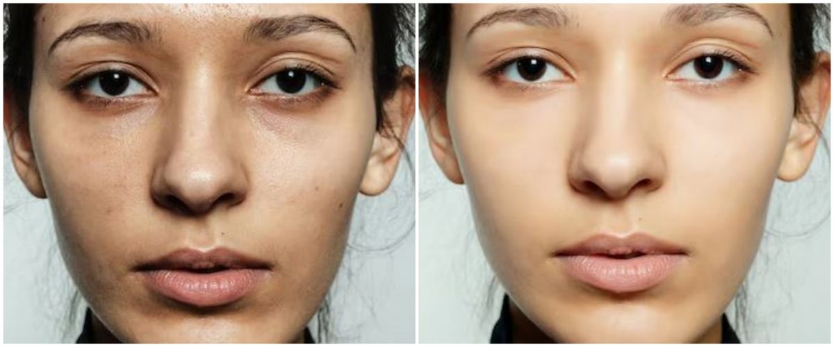 No need to buy a facial scrub, here's how to whiten dull skin full of ...