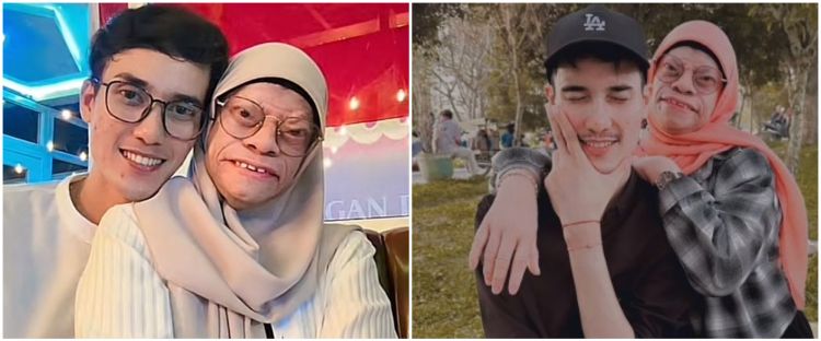 Jalinan cintanya dicibir tahan 1 bulan, Yuni Manurung pengidap sindrom ...