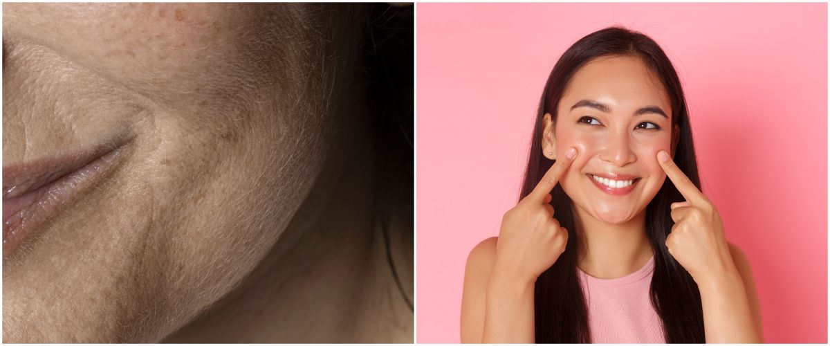 So it's smooth and free of cracks. This is how to treat dry skin using ...