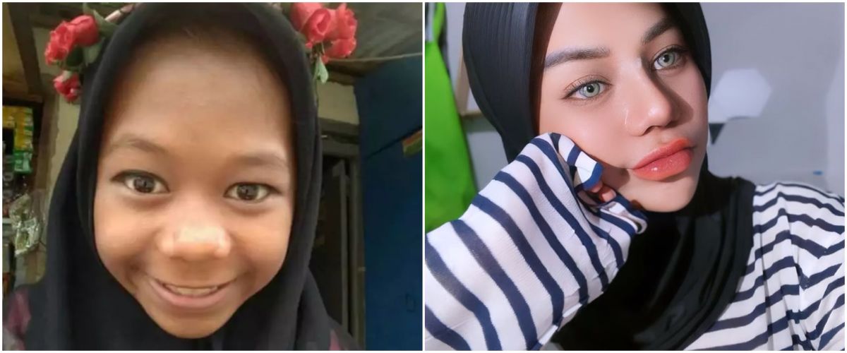 From facials to nose jobs, here are 7 portraits of Cimoy's facial changes from the moment he ...