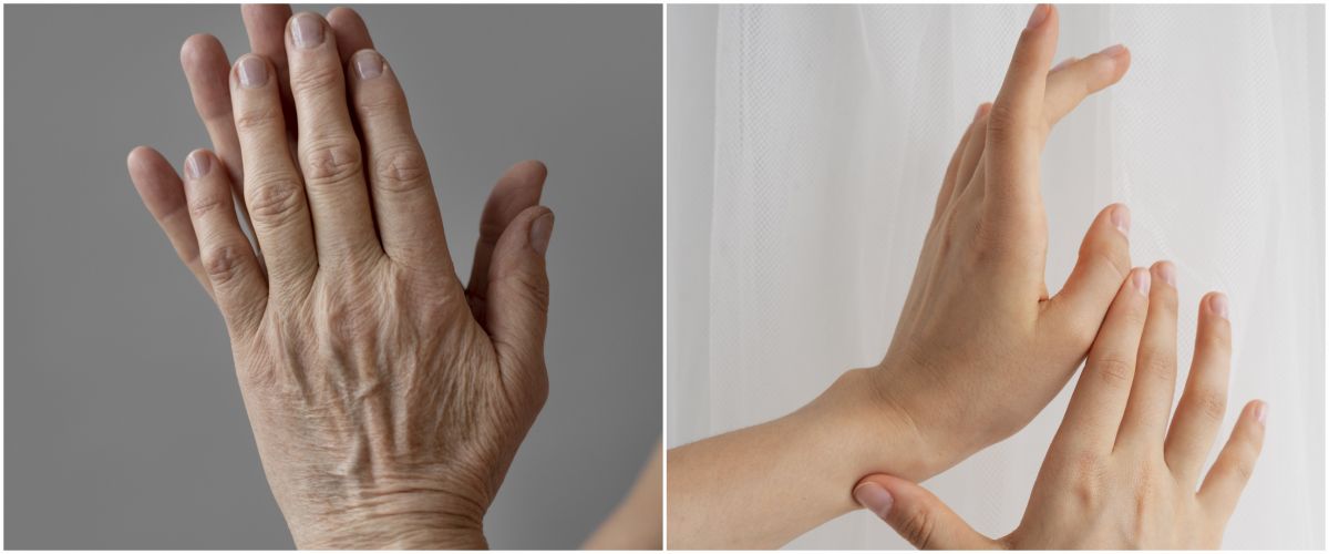 Without mixing lemon and egg yolk, this is a way to treat wrinkles on ...