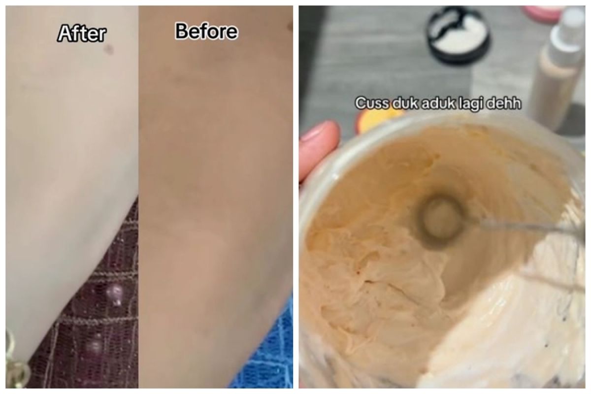 This combination of Kelly cream and viral powder can make your skin as ...