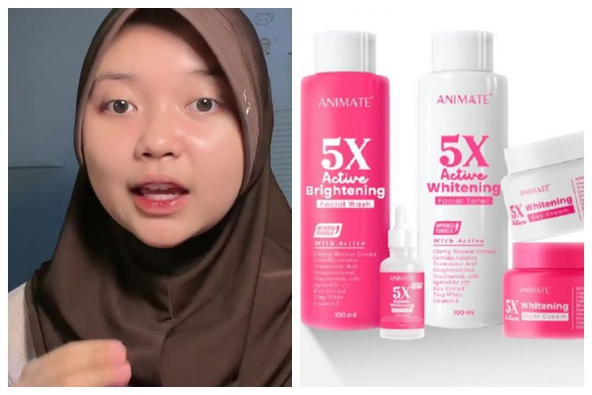 Package less than IDR 100 thousand, this is a review of Animate Skincare 5x Active Whitening ...