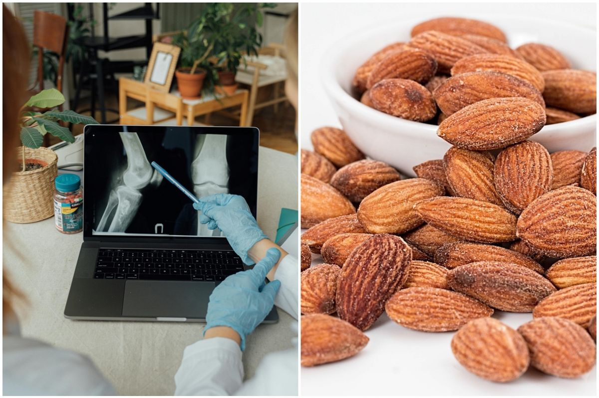 [QUIZ] Is your favorite food good for your bones? Find out with these 5 ...
