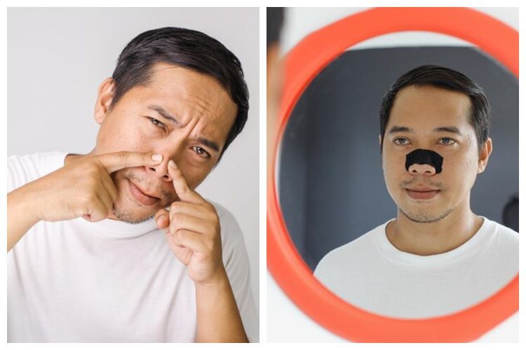 Takut wajah berkomedo karena salah pakai produk? Simak 7 cara cek ...