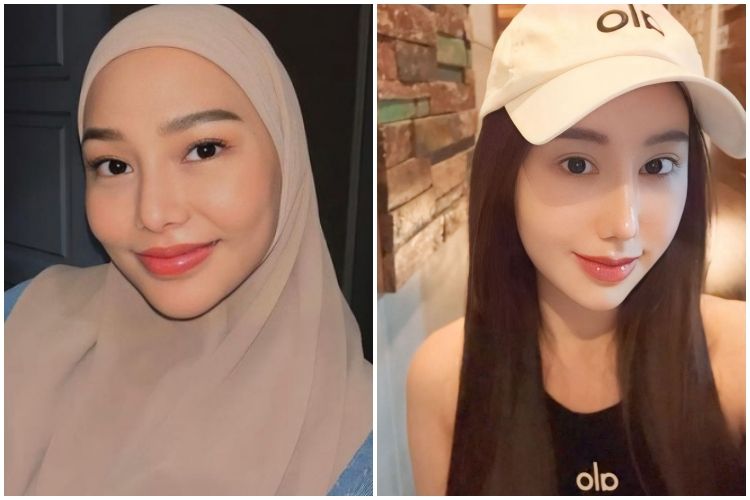 7 Potret before-after selebgram usai oplas ini manglingi, Wendy Walters sebut perbaiki hidung miring